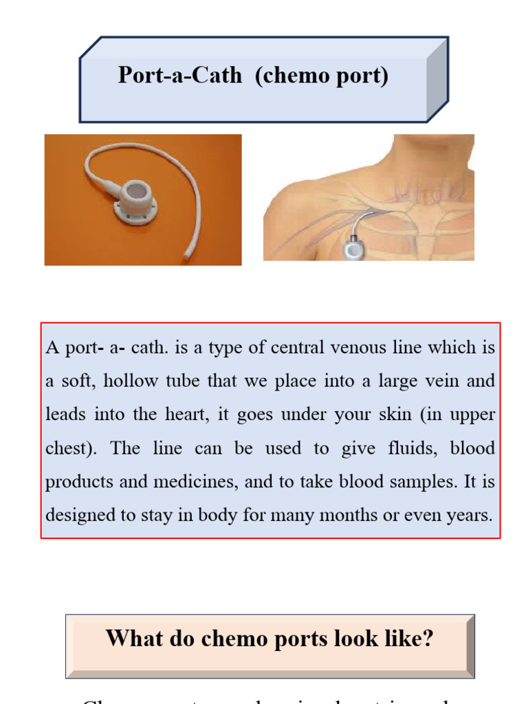 Port A Cath | Download Free PDF | Clinical Medicine | Medical Specialties