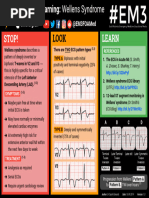 Wellens Syndrome ECG Patterns Explained | PDF | Myocardial Infarction ...