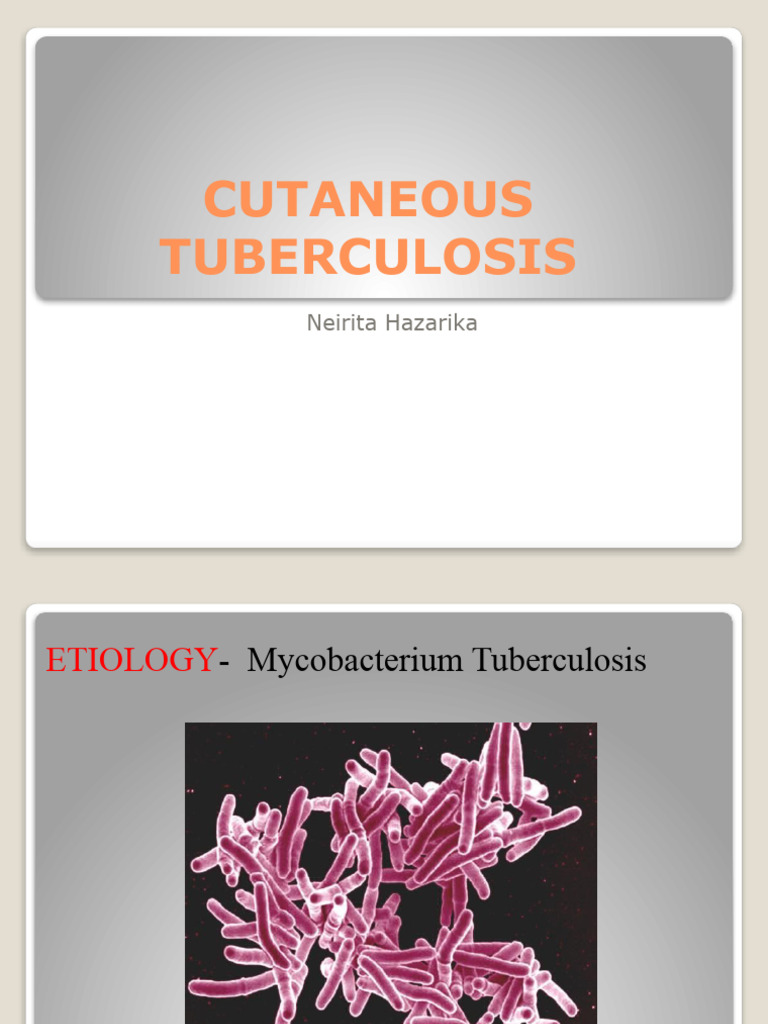 Cutaneous Tuberculosis | Download Free PDF | Tuberculosis | Medical ...