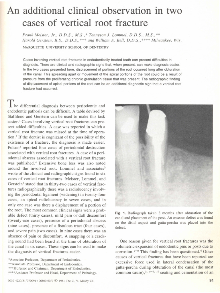An Additional Clinical Observation in Two Cases of Vertical Root ...