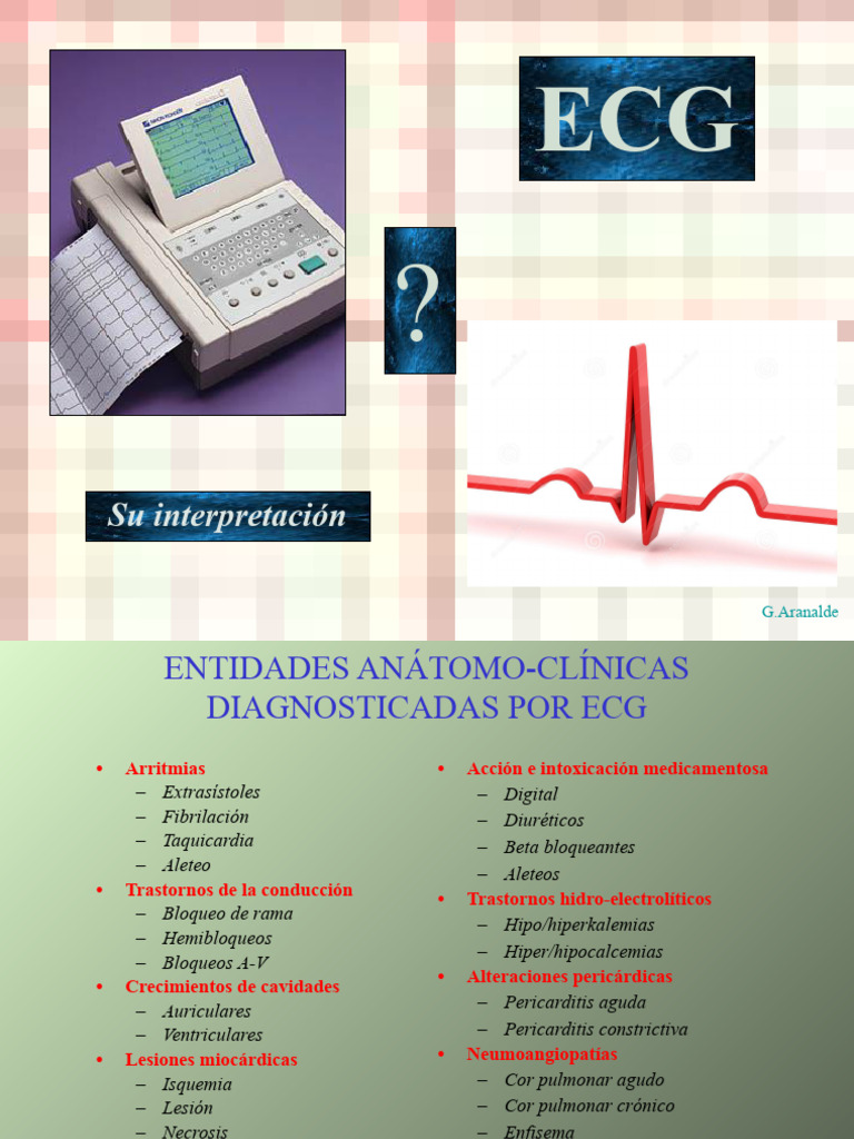 ECG básico.ppt | PDF | Electrocardiografia | Medicina Interna