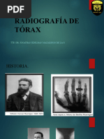 Radiografía de Tórax Normal - Patrón Intersticial | PDF | Pulmón | Tórax