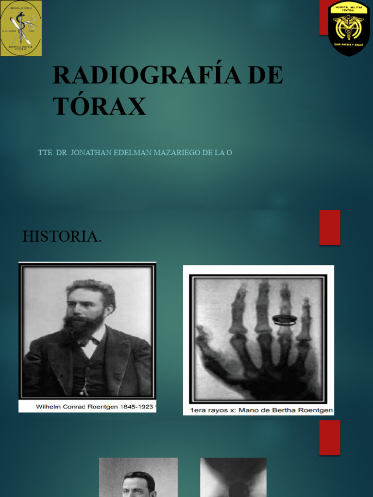 Interpretación de Radiografía de Tórax | PDF | Tórax | Pulmón
