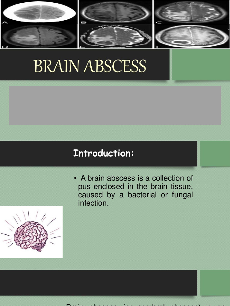 Brain Abscess | PDF
