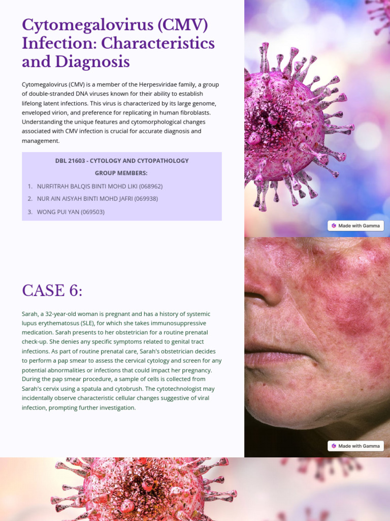 Cytomegalovirus CMV Infection No Watermark | PDF | Virus | Infection