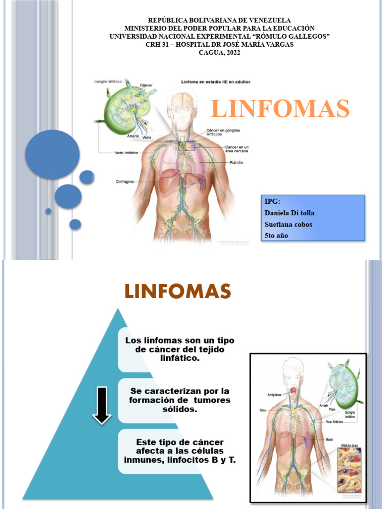 linfomas | PDF | Cáncer | Linfoma