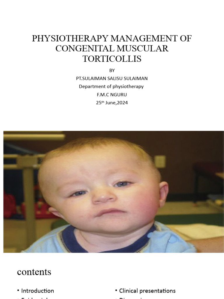 Physiotherapy Management Of Congenital Muscular Torticollis Pdf