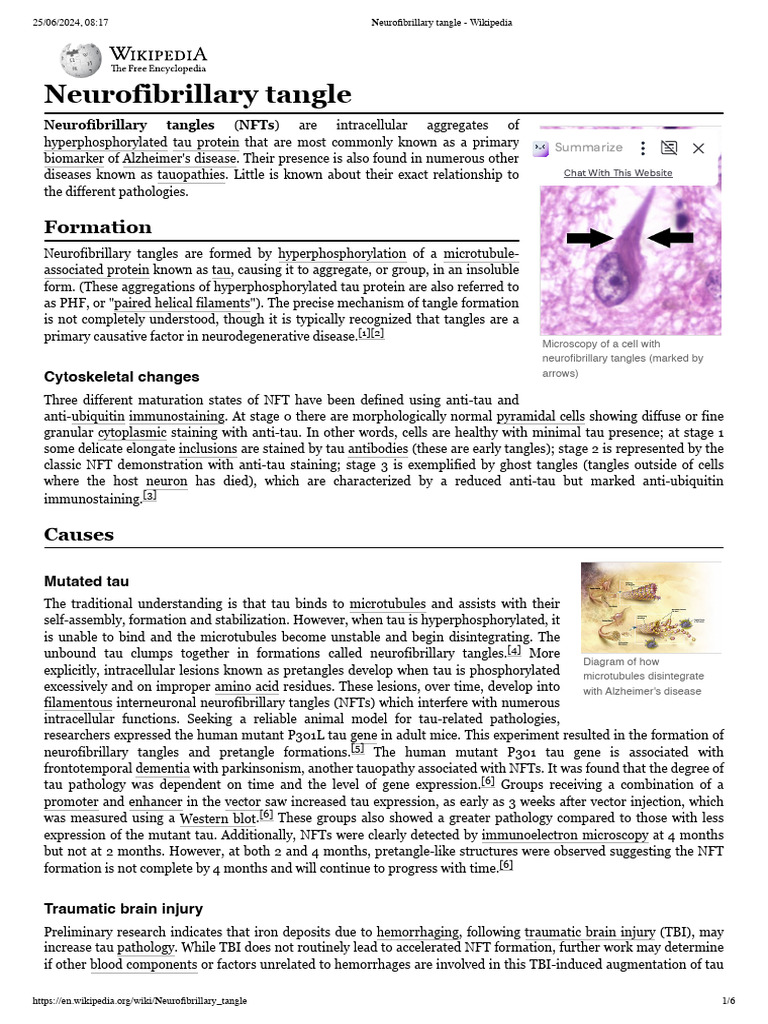 Neurofibrillary Tangle | PDF | Biology | Clinical Medicine