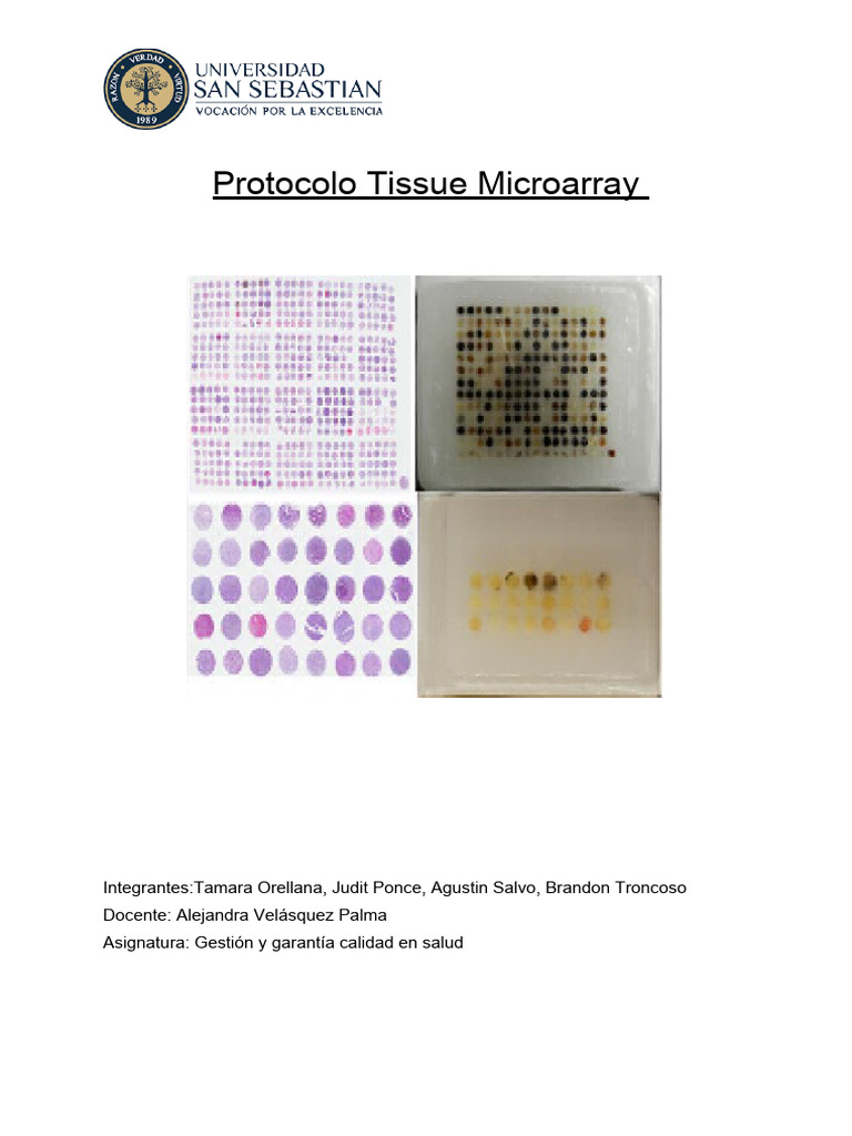 Protocolo Tissue Microarray Grupo 2 | PDF | Cáncer | Cáncer de mama