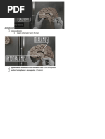 Subcutaneous Butterfly Insertion Guide | PDF | Intravenous Therapy ...