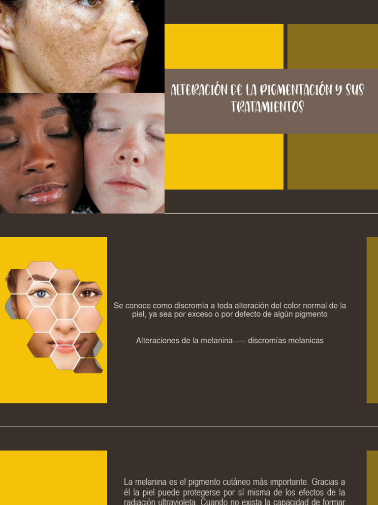 Discromías de la piel: causas y tratamientos | PDF | Epidermis | Color ...