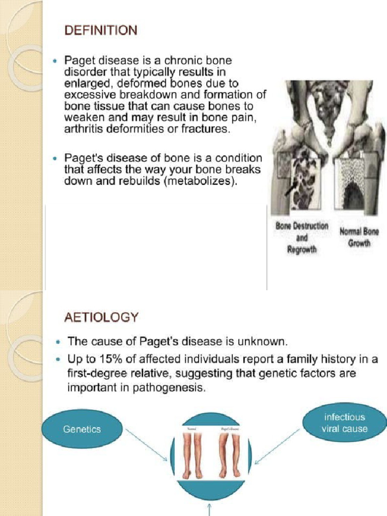 Paget disease | PDF