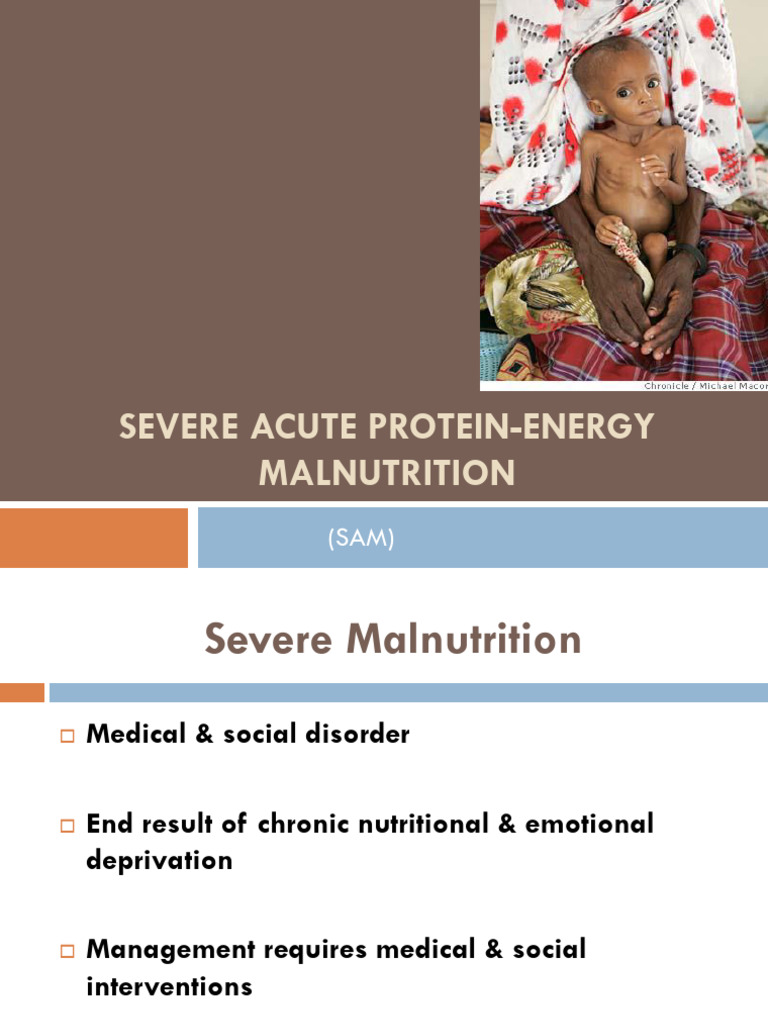 Malnutrition - Final | PDF | Malnutrition | Edema