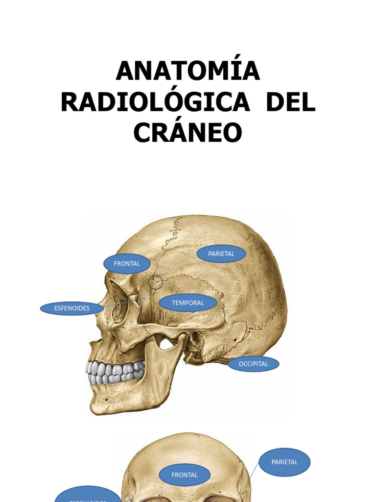 Anatomia Radiologica De Craneo Pdf Otorrinolaringología Sistema