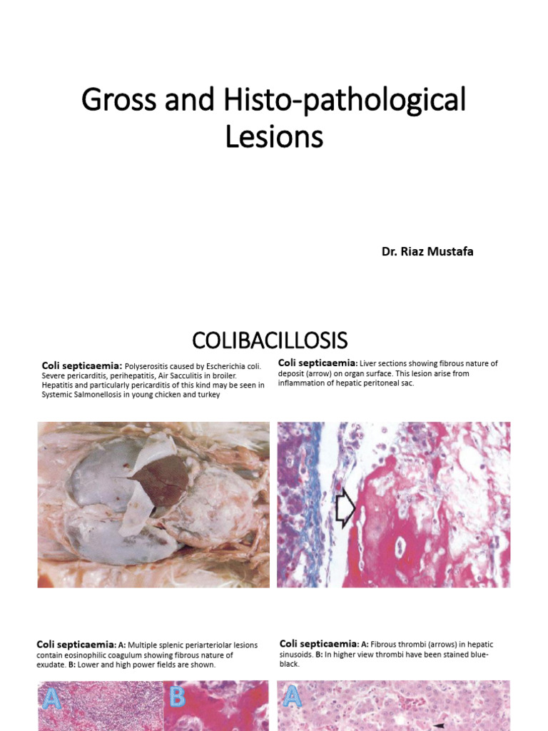 Gross and Histopathological Lesions | PDF | Liver | Sepsis