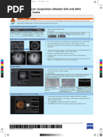 Optovue iVue OCT User Manual | PDF | Retina | Eye
