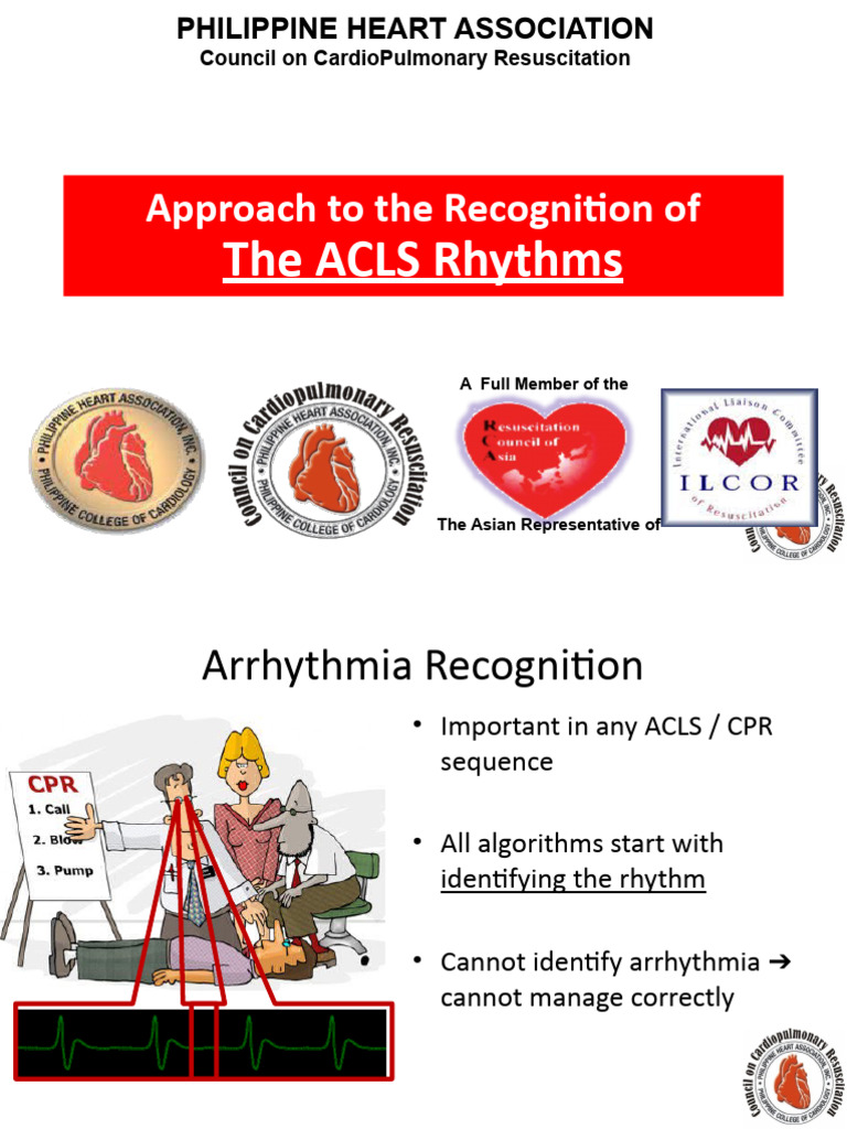 APPROACH TO ACLS RHYTHMS by Dra. Adviento 11.11.16 | PDF ...