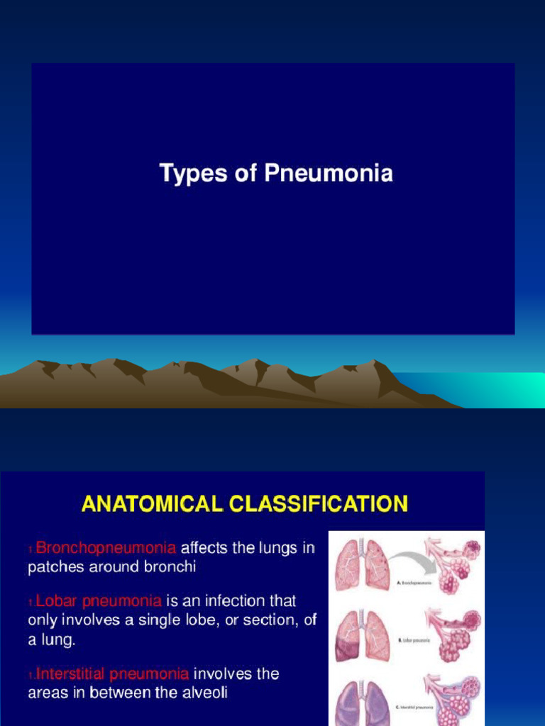 -Types of Pneumonia-2021 — Копия 2 | PDF