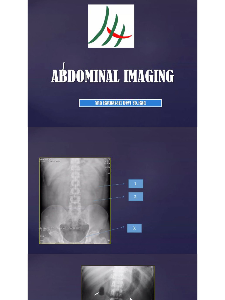Radioimaging of Digestive System (SRD) | PDF