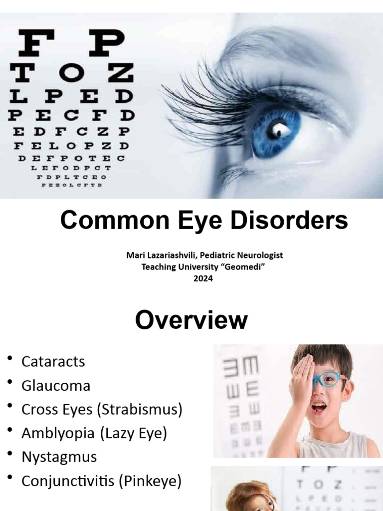 Overview of Common Eye Disorders | PDF | Glaucoma | Cataract