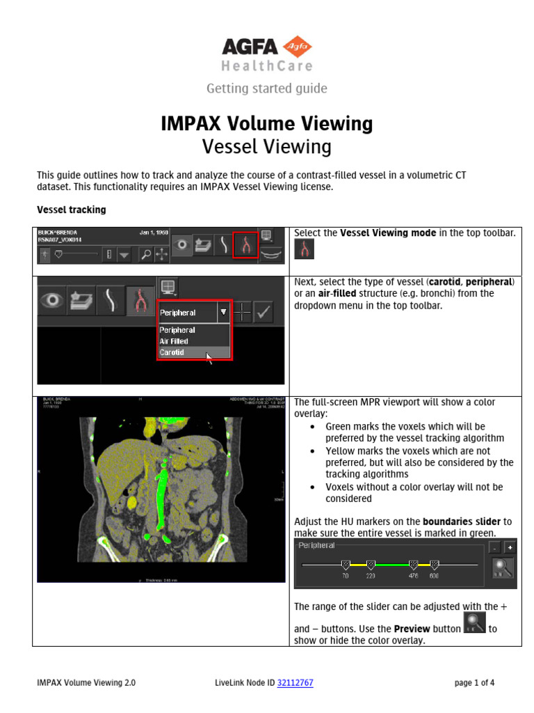 IMPAX Volume Viewing 2.0 - Vessel Viewing | PDF | Area | Page Layout
