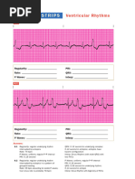 Basic EKG ECG Rhythms Cheatsheet | PDF | Electrocardiography | Cardiac ...