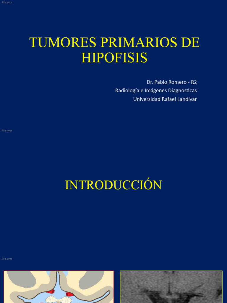Silla Turca PR | PDF | Endocrino | Endocrinología
