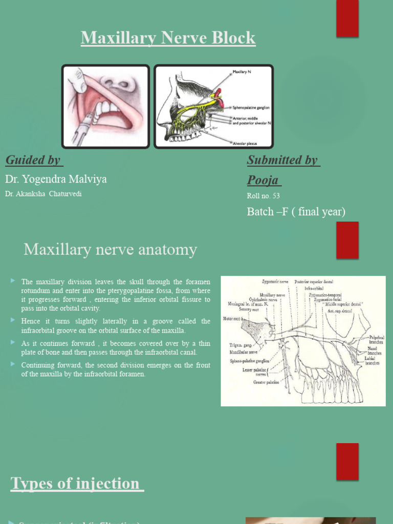 Maxillary Nerve Block Techniques | PDF | Anesthesia | Injection (Medicine)
