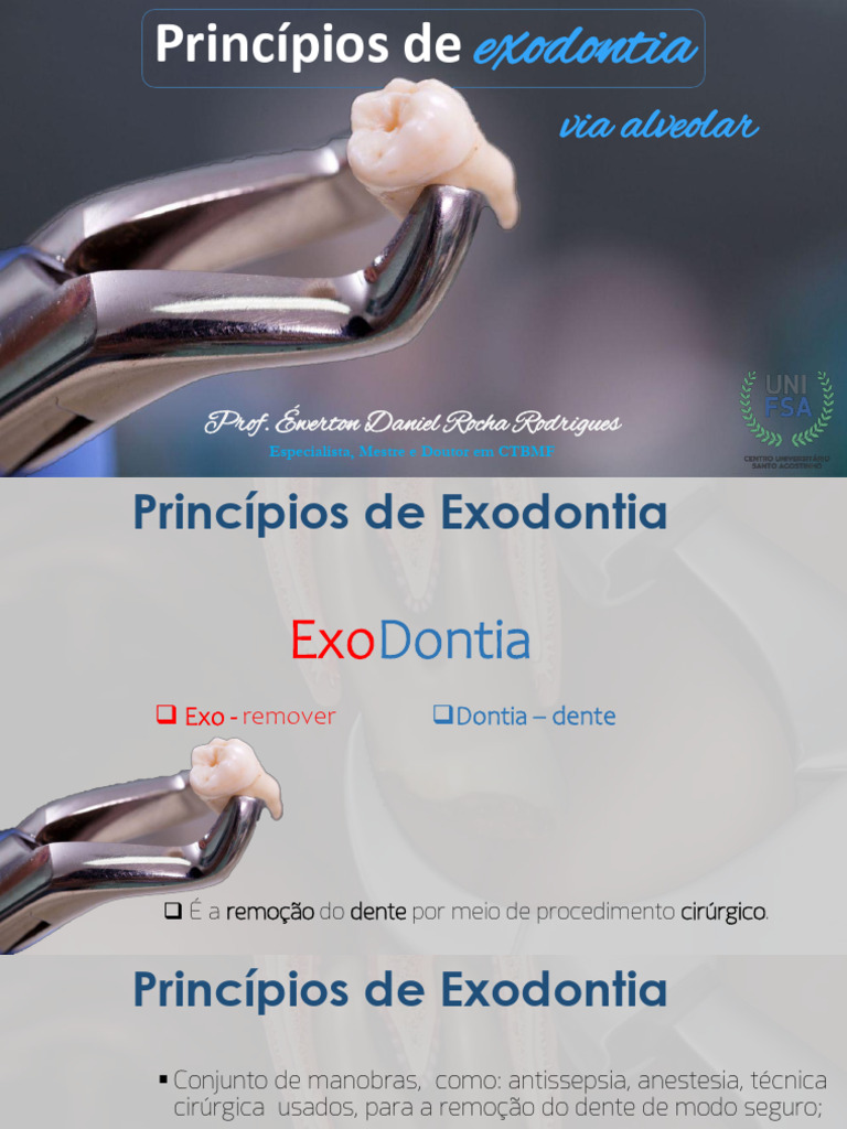 Princípios de Exodontia (exodontia via alveolar) | PDF | Odontologia ...
