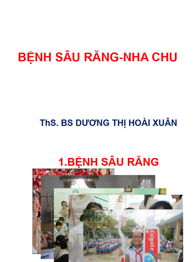 Bệnh Sâu Răng-nha Chu | PDF