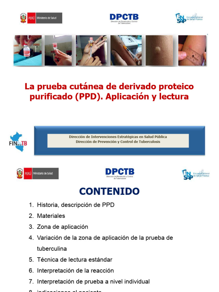 Prueba PPD: Aplicación y Lectura | PDF | Inyección (medicina) | Tuberculosis