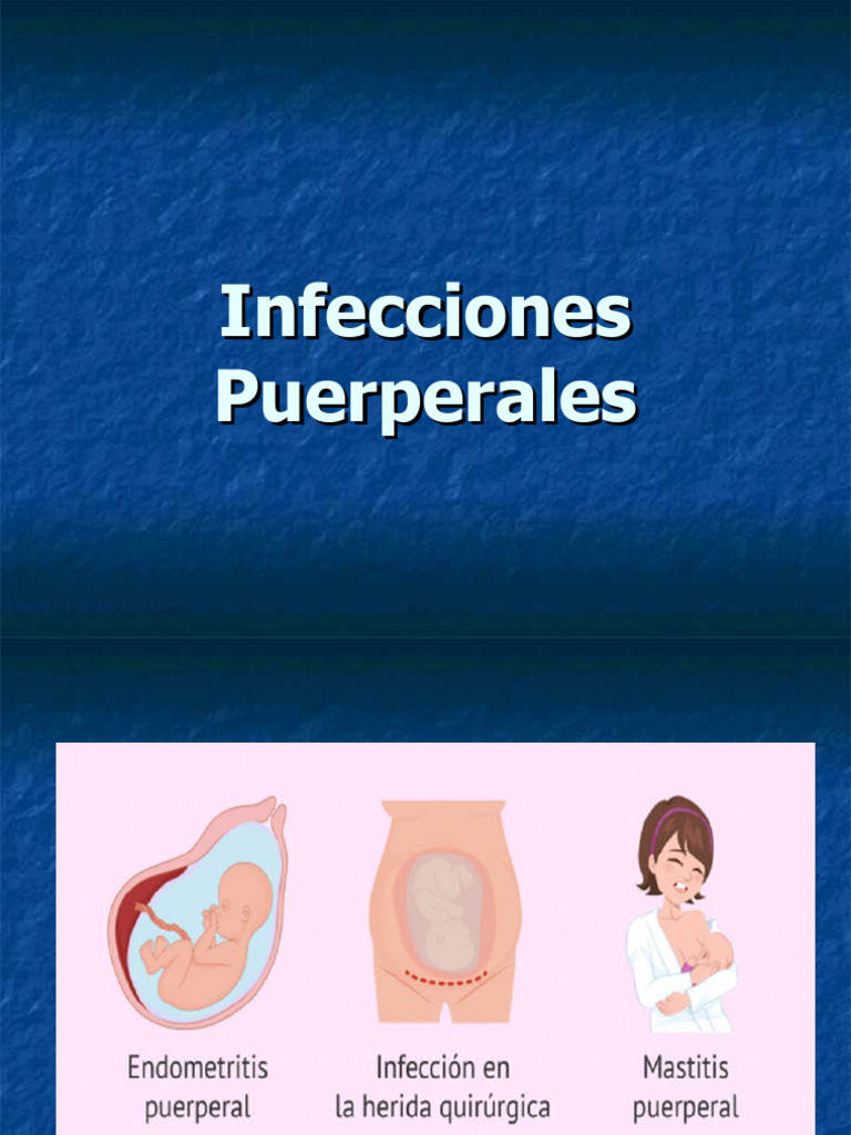 Infecciones Puerperales 2021 | PDF | Parto | Periodo posparto