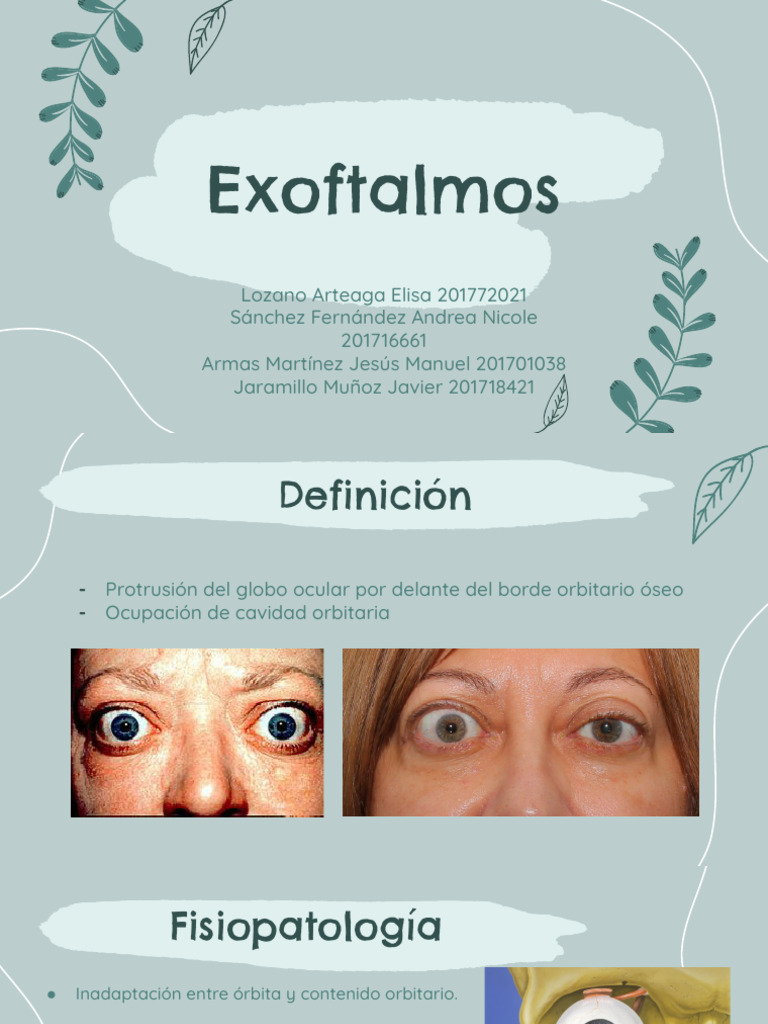 Exoftalmos | PDF | Medicina CLINICA | Especialidades Medicas