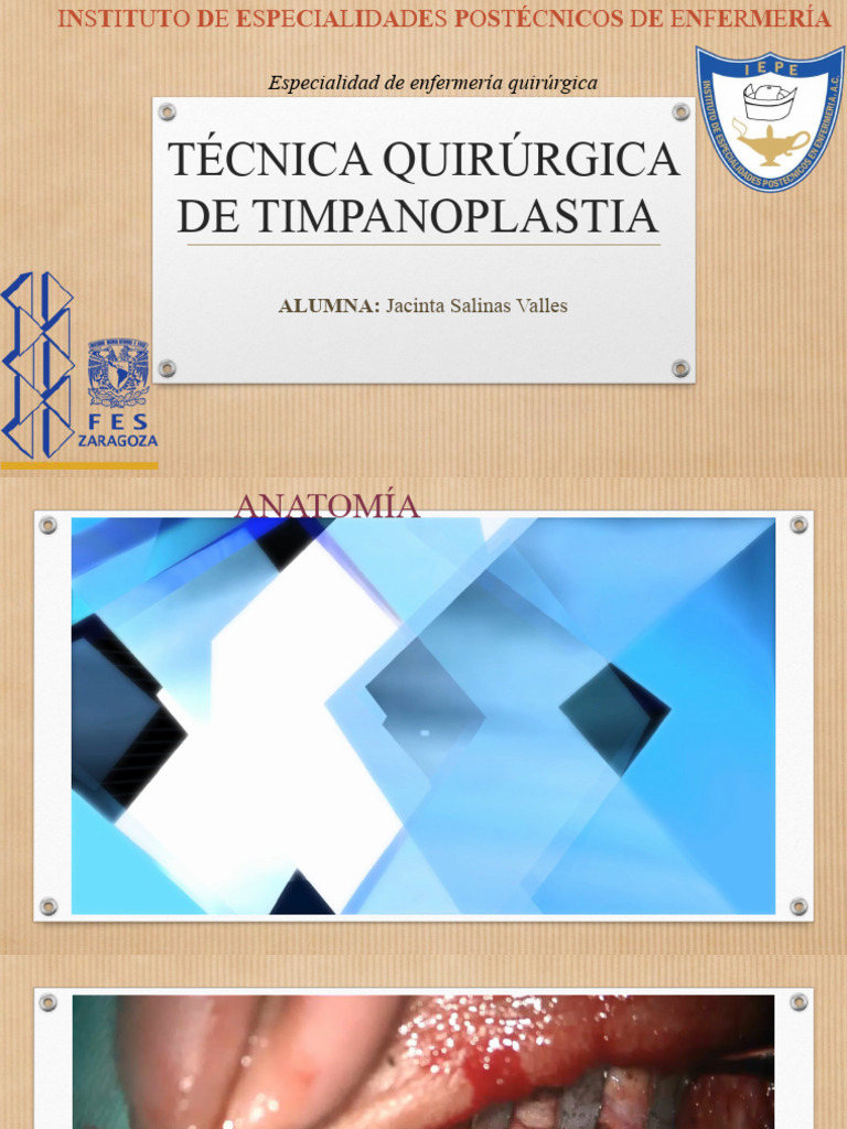 Técnica de Timpanoplastia Quirúrgica | PDF | Cirugía