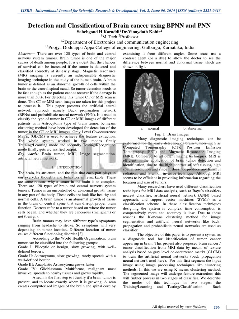 Detection and Classification of Brain CA | PDF | Image Segmentation | Cluster Analysis