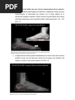Comparativa: Ángulos de Meary y Costa-Bartani | PDF | Pie | Sistema ...