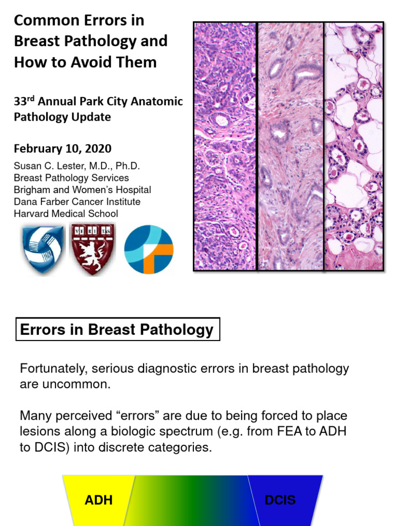 Common Errors in Breast Pathology | PDF | Metastasis | Breast Cancer
