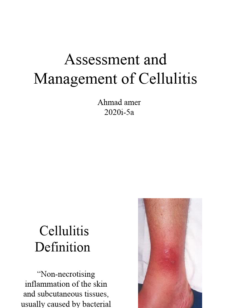 Cellulitis | Download Free PDF | Clinical Medicine | Medical Specialties