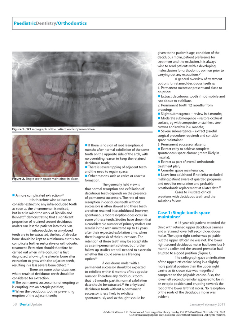 Serial Extractions-1-8-Pages-4 | PDF | Orthodontics | Human Tooth