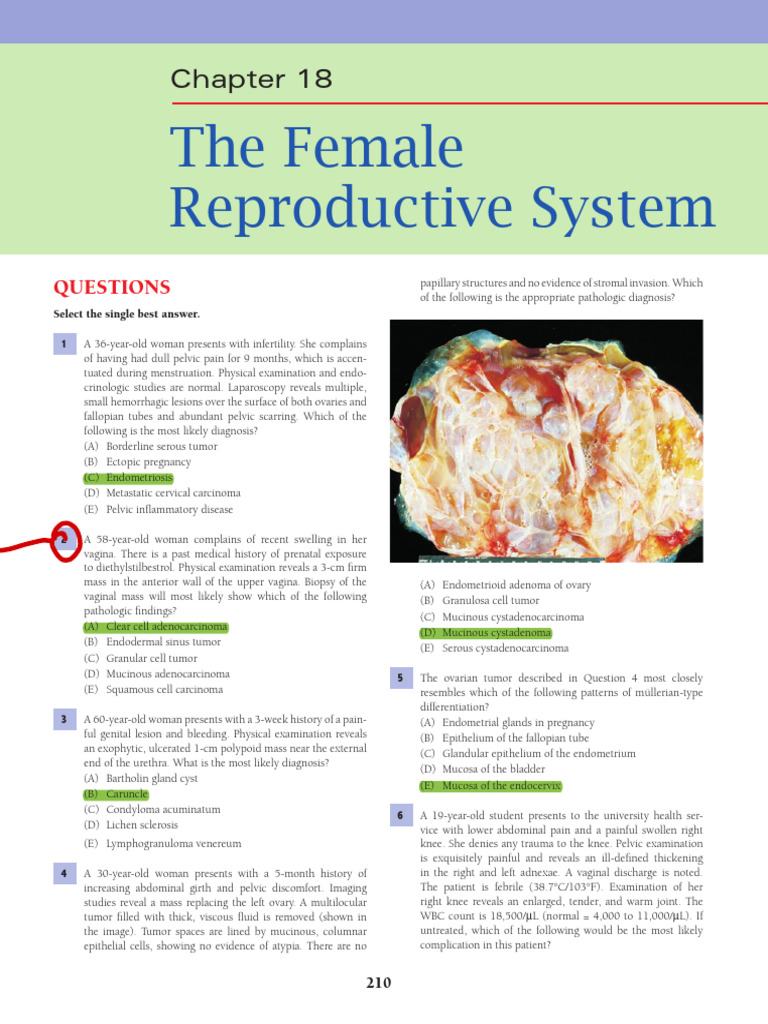 Female System - Lippincotts | PDF | Ovarian Cancer | Uterus