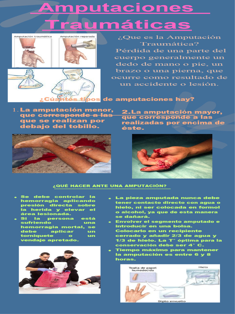 Infografia Amputaciòn | PDF