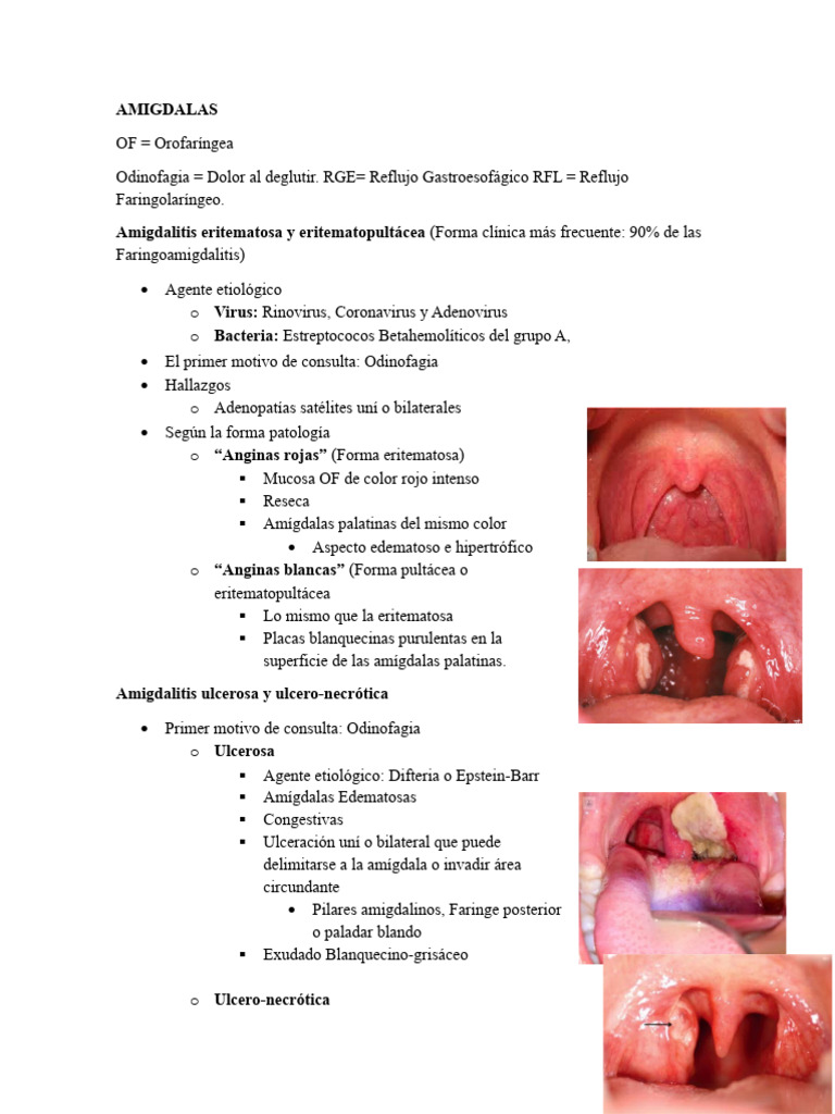AMIGDALITIS | PDF | Enfermedades y trastornos | Especialidades Medicas