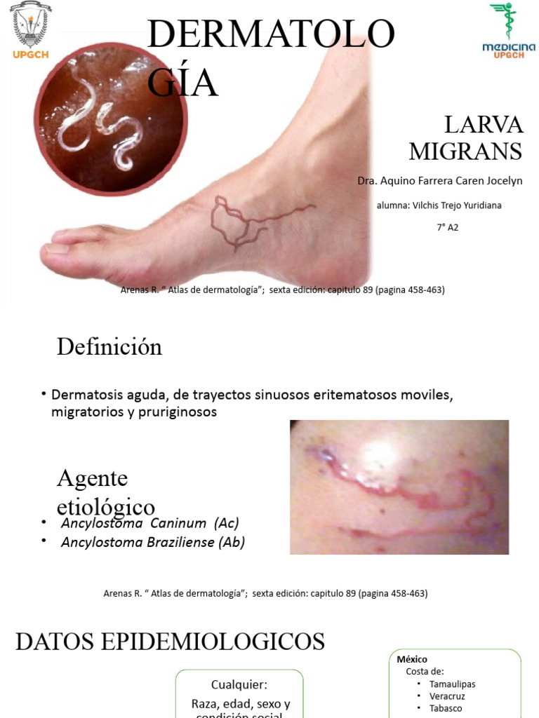 LARVA MIGRANS Nvo | PDF | Especialidades Medicas | Enfermedades y ...