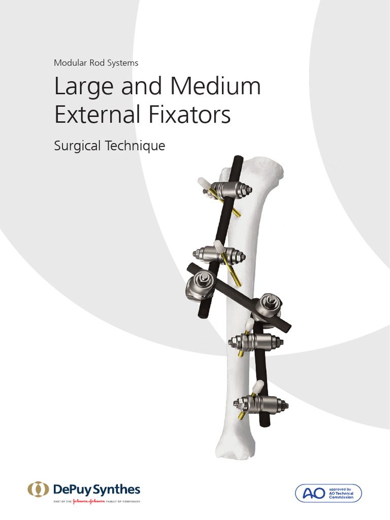 Large and Medium External Fixators | PDF | Magnetic Resonance Imaging ...