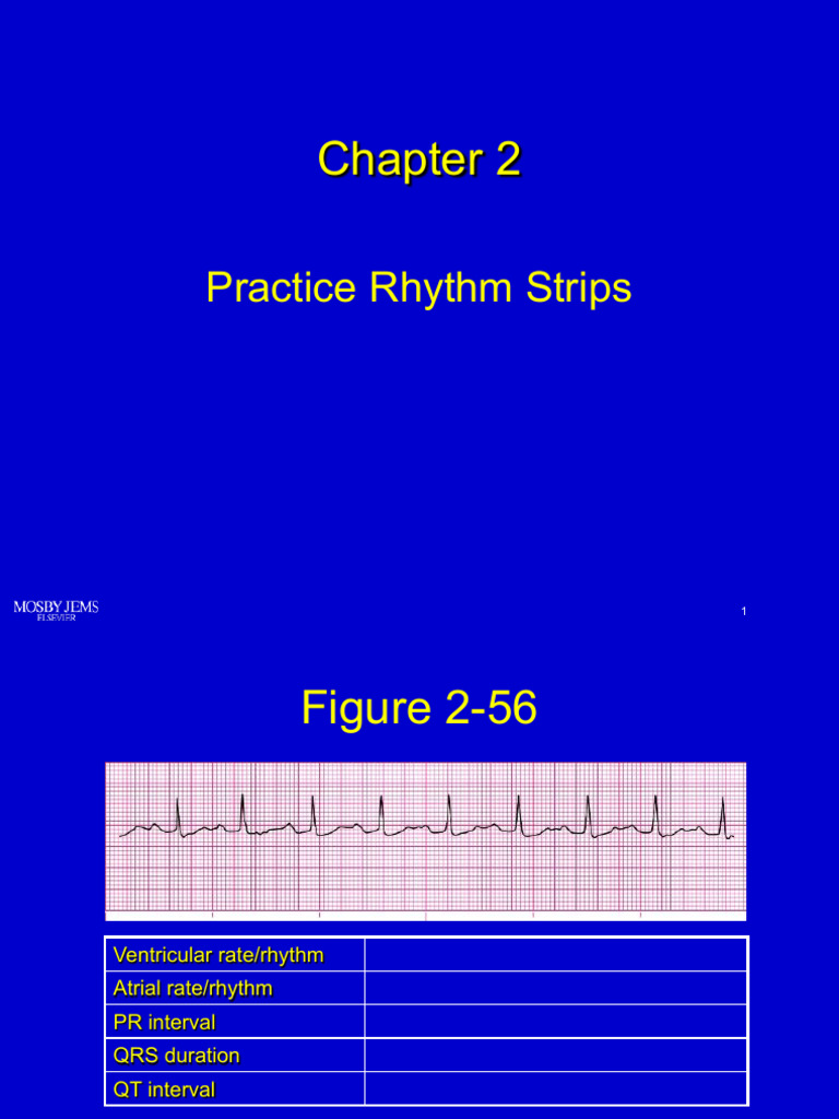 Chapter 002 1practicerhytmstrips | PDF | Heart Rate | Cardiovascular ...