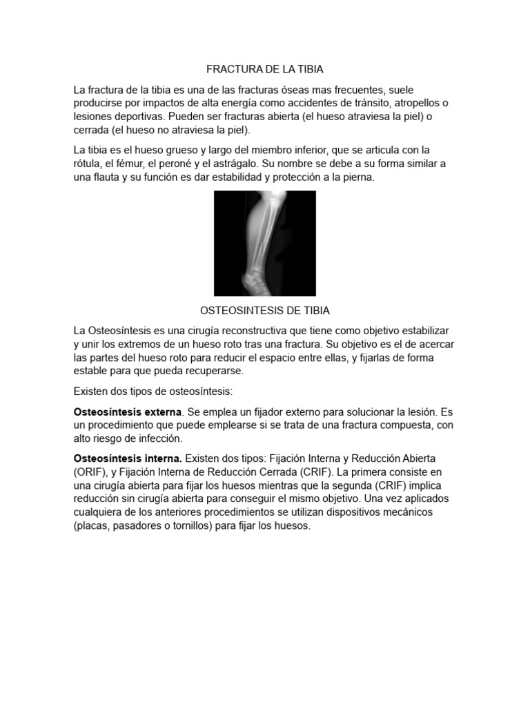 Osteosintesis de Tibia | PDF