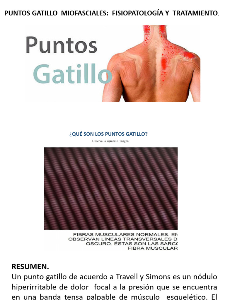Guía sobre Puntos Gatillo Musculares | PDF | Músculo | Punto gatillo ...