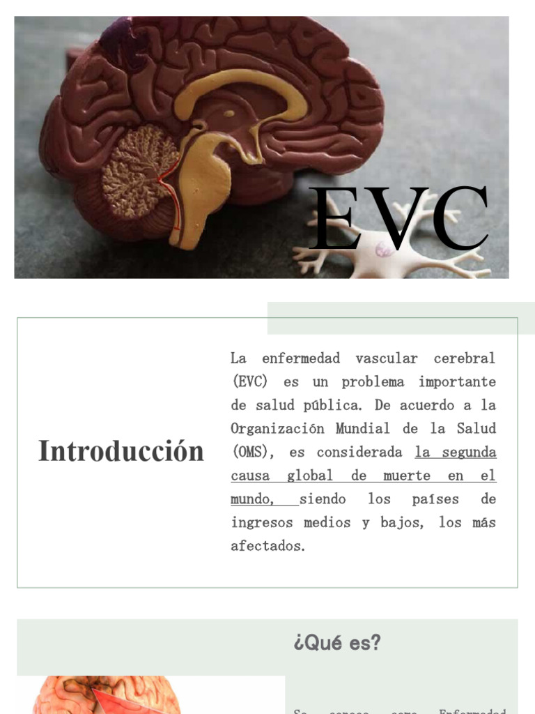 EVC | Descargar gratis PDF | Carrera | Isquemia