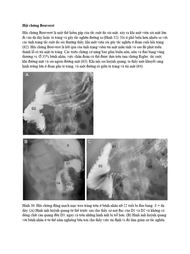 Chẩn Đoán x Quang | PDF