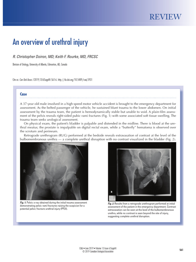 Rupture Urethra Doiron | PDF | Surgical Specialties | Medical Specialties